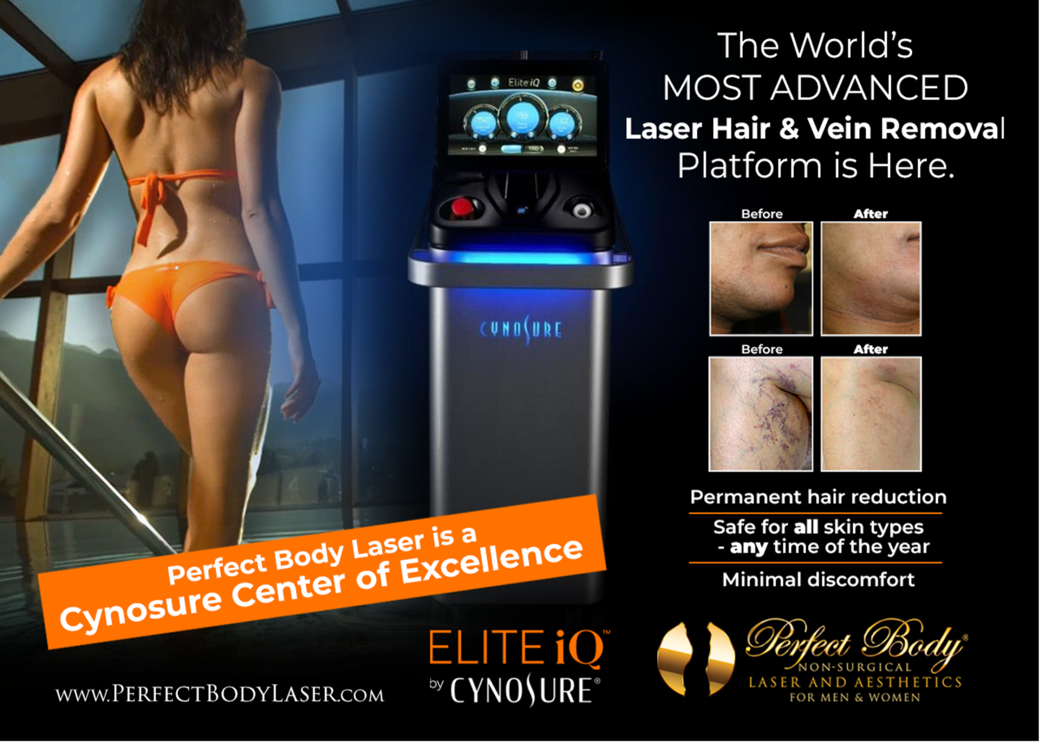 Elite iQ | Perfect Body Laser